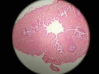 Free Surface Tutorial