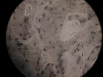 Bone Histology