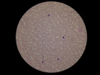 Connective Tissue Histology