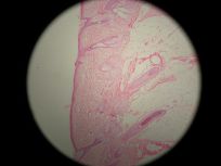 Epithelium Histology