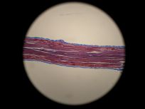 Muscle Histology