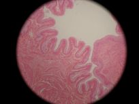Urinary Histology