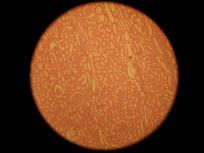 Urinary Histology
